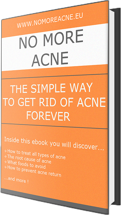 No More Acne | Get rid of acne forever ! - Payhip